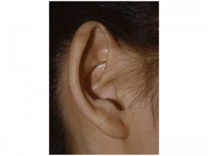 Ear Presentation - Dr. Robert Ruder