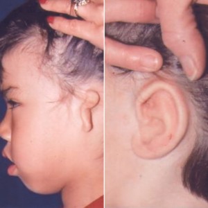 Dr. Robert Ruder - Plastic Surgery - Beverly Hills, California